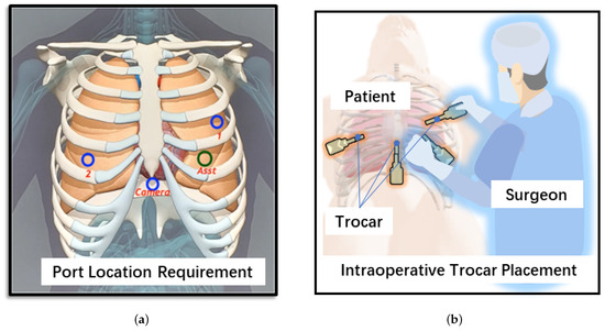 Dynamic Virtual Fixture Generation Based on Intra-Operative 3D Image ...