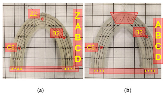Bite Force Mapping Based on Distributed Fiber Sensing Network Approach