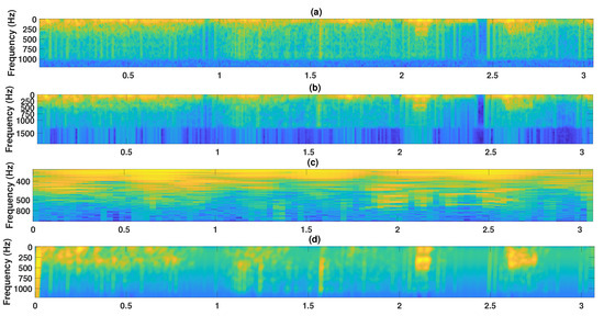 Classification of Adventitious Sounds Combining Cochleogram and Vision ...