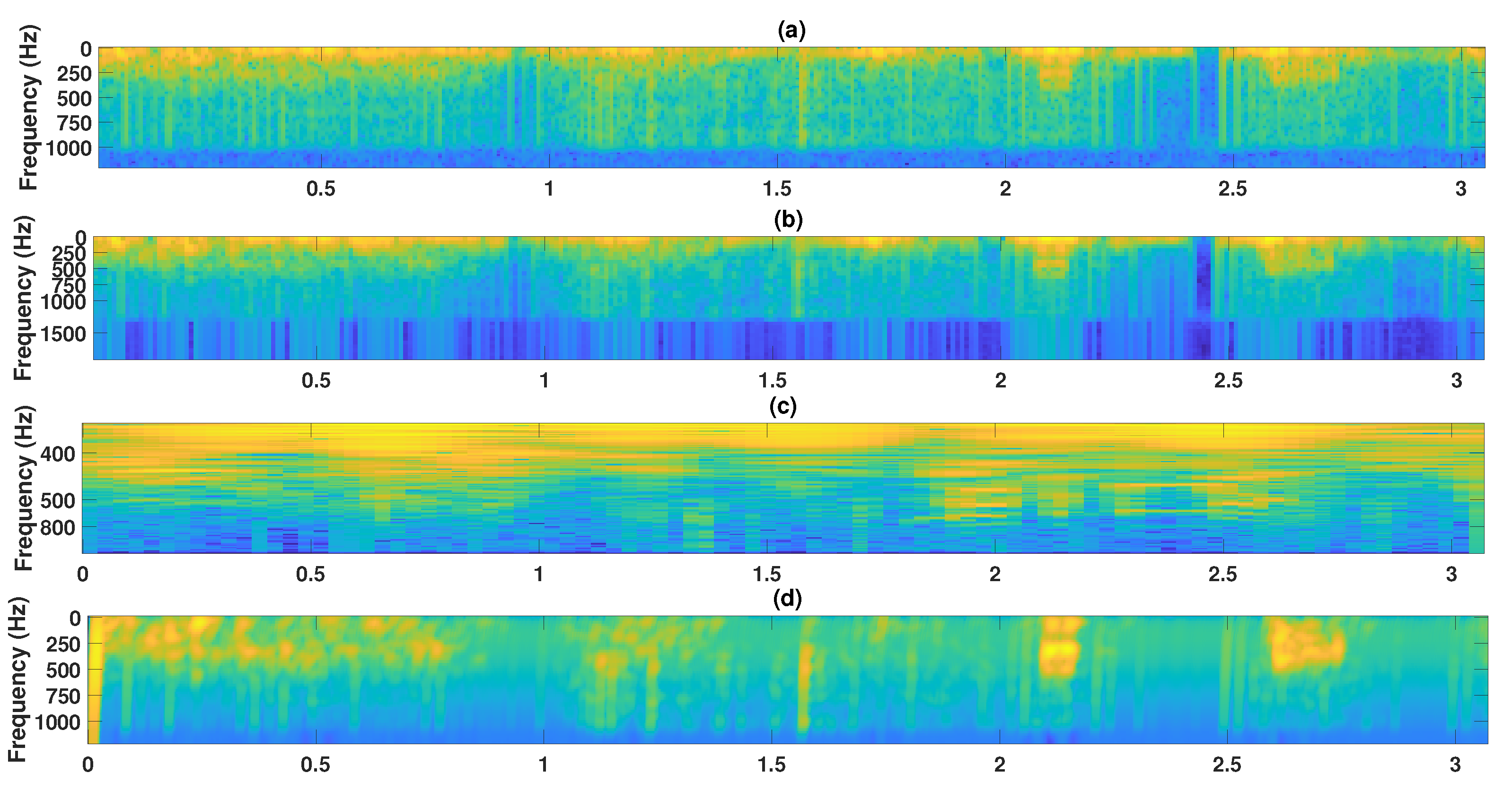 Sensors | Free Full-Text | Classification of Adventitious Sounds ...