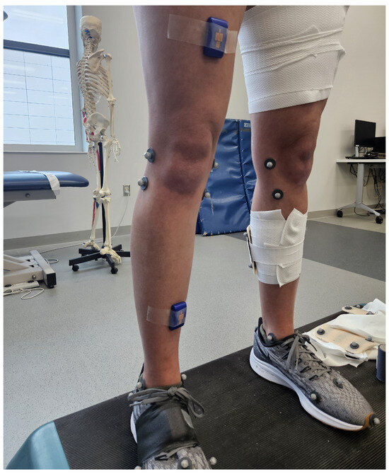 Knee Angle Estimation with Dynamic Calibration Using Inertial ...