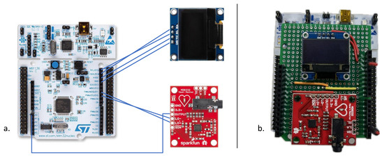Real-Time Myocardial Infarction Detection Approaches with a ...