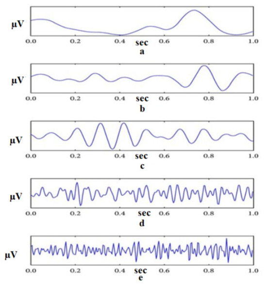 Sensors | Free Full-Text | Exploring Convolutional Neural Network Architectures for EEG Feature ...