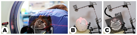 Sensors | Free Full-Text | The Feasibility and Accuracy of Holographic ...