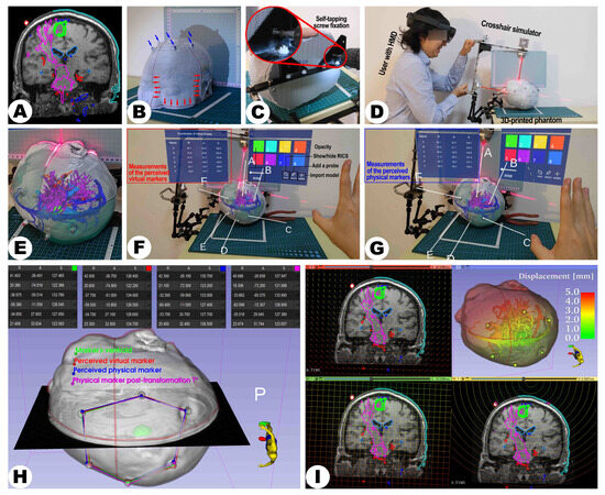 Sensors | Free Full-Text | The Feasibility and Accuracy of Holographic ...