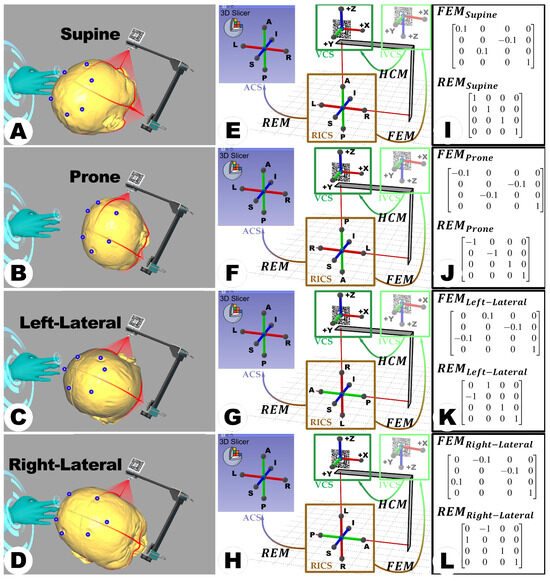 Sensors | Free Full-Text | The Feasibility and Accuracy of Holographic ...