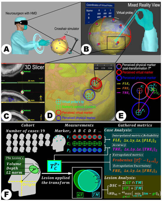 Sensors | Free Full-Text | The Feasibility and Accuracy of Holographic ...
