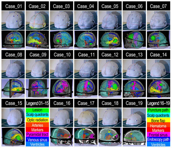 Sensors | Free Full-Text | The Feasibility and Accuracy of Holographic ...