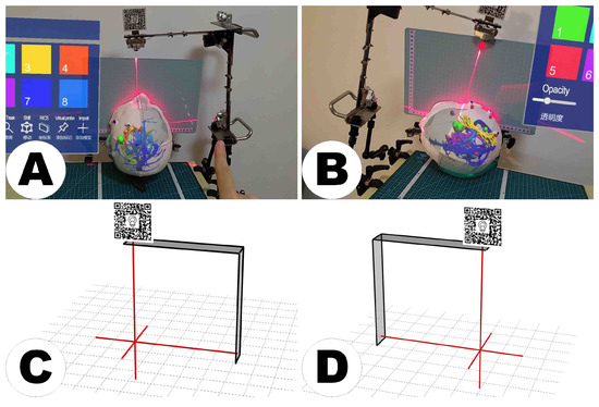 Sensors | Free Full-Text | The Feasibility and Accuracy of Holographic ...