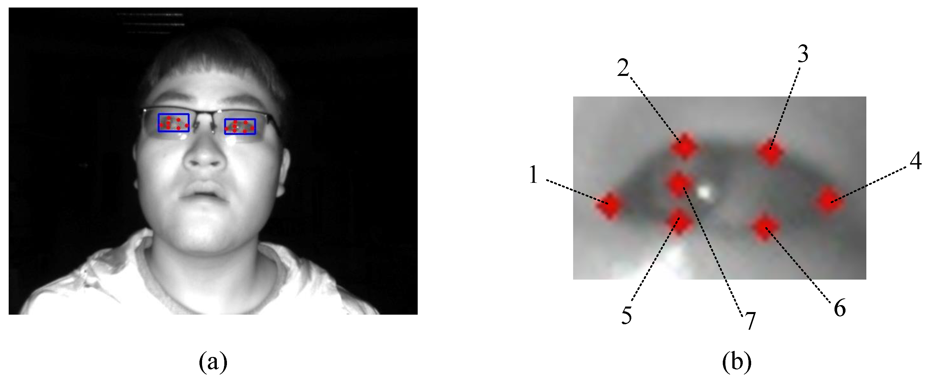 Sensors | Free Full-Text | Model-Based 3D Gaze Estimation Using a TOF Camera
