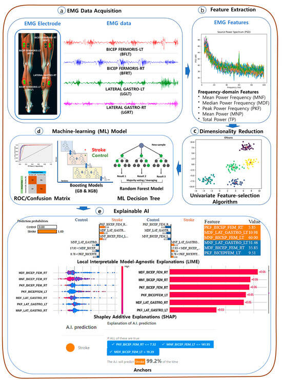 Interpreting Stroke-Impaired Electromyography Patterns through Explainable Artificial Intelligence