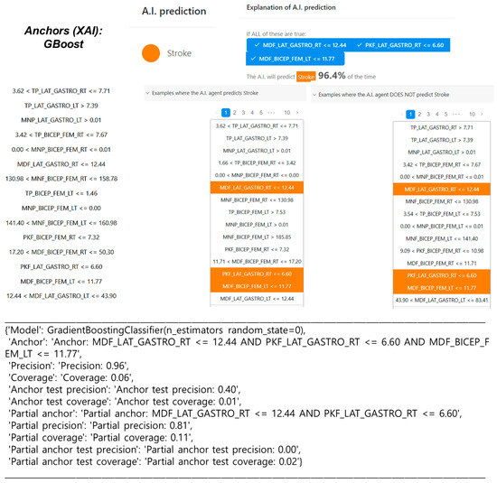 Interpreting Stroke-Impaired Electromyography Patterns through Explainable Artificial Intelligence