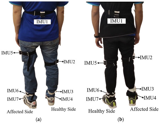 Sensors | Free Full-Text | Inertial Measuring System to Evaluate Gait Parameters and Dynamic ...