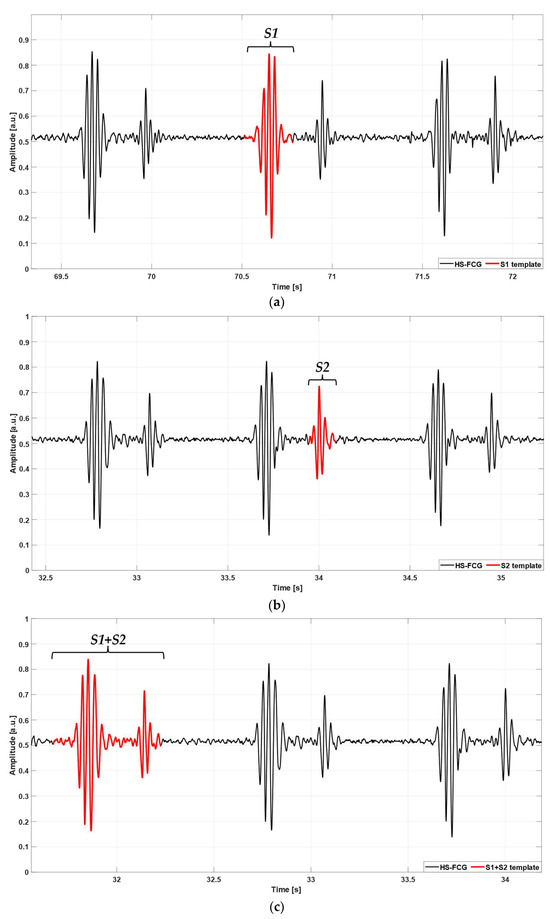 Sensors | Free Full-Text | Accurate Localization of First and Second Heart Sounds via Template ...