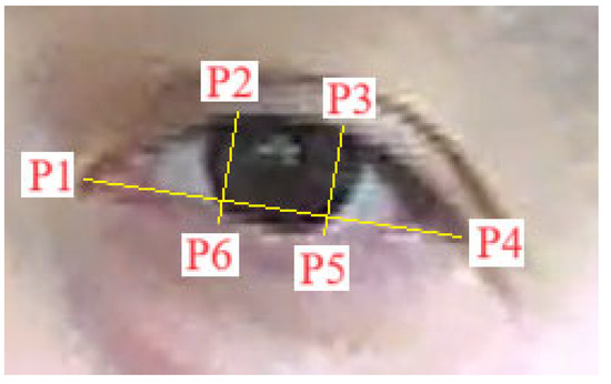 Driver Drowsiness Multi-Method Detection for Vehicles with Autonomous ...