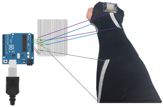Measurement of 3D Wrist Angles by Combining Textile Stretch Sensors and AI Algorithm