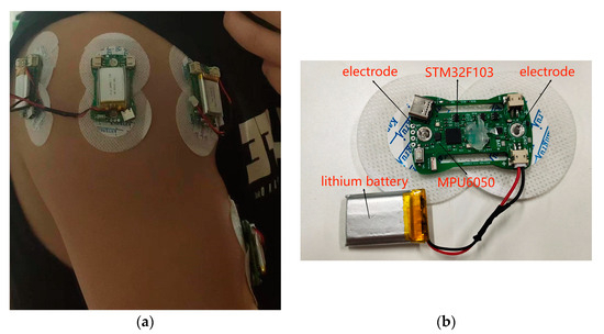 Estimating Rotational Acceleration in Shoulder and Elbow Joints Using a ...