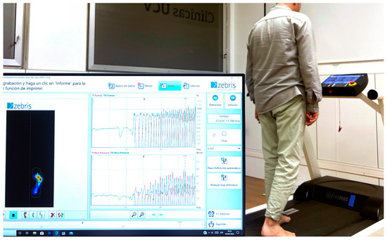 Relationship between Body Posture Assessed by Dynamic Baropodometry and ...