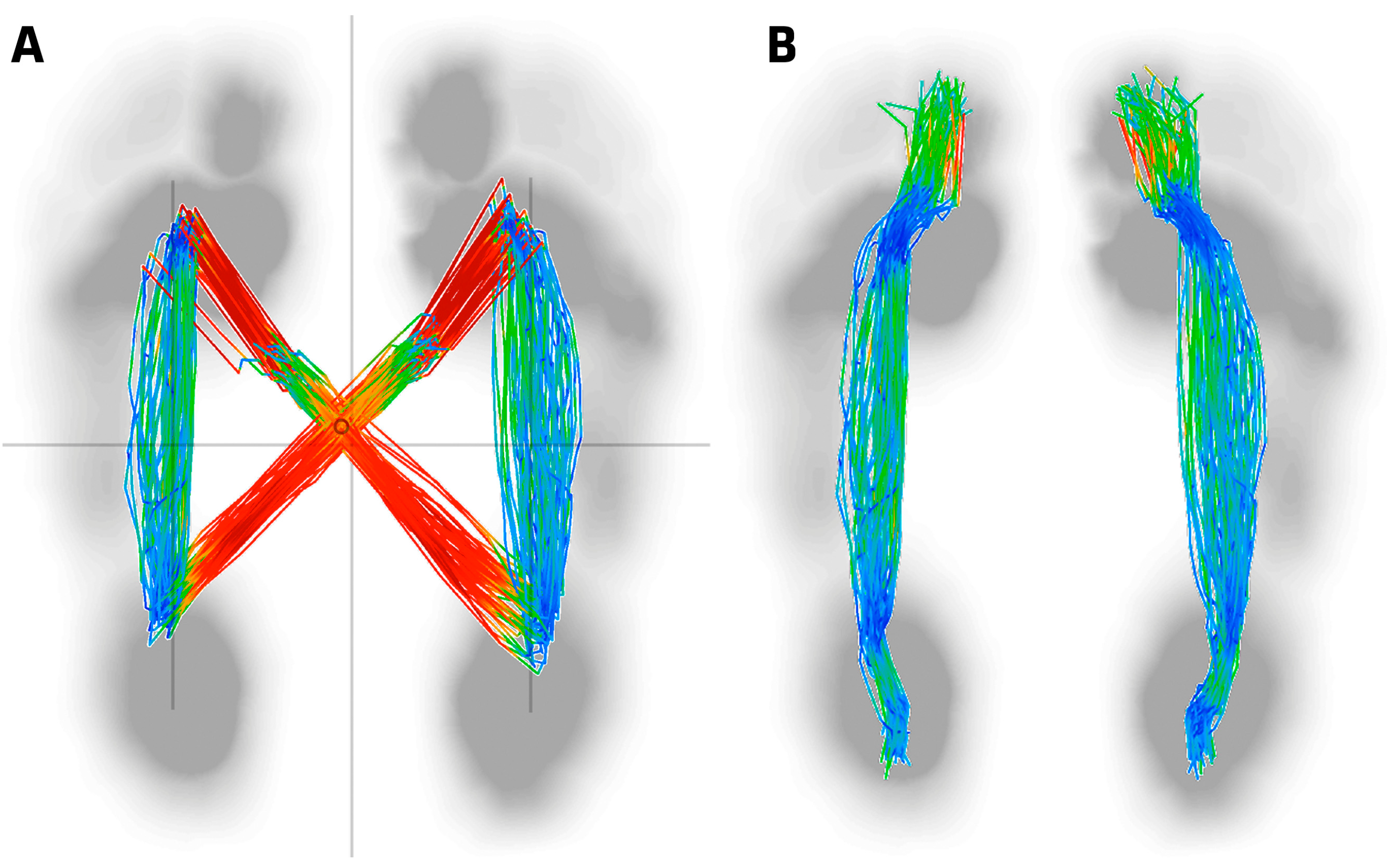 Relationship between Body Posture Assessed by Dynamic Baropodometry and ...