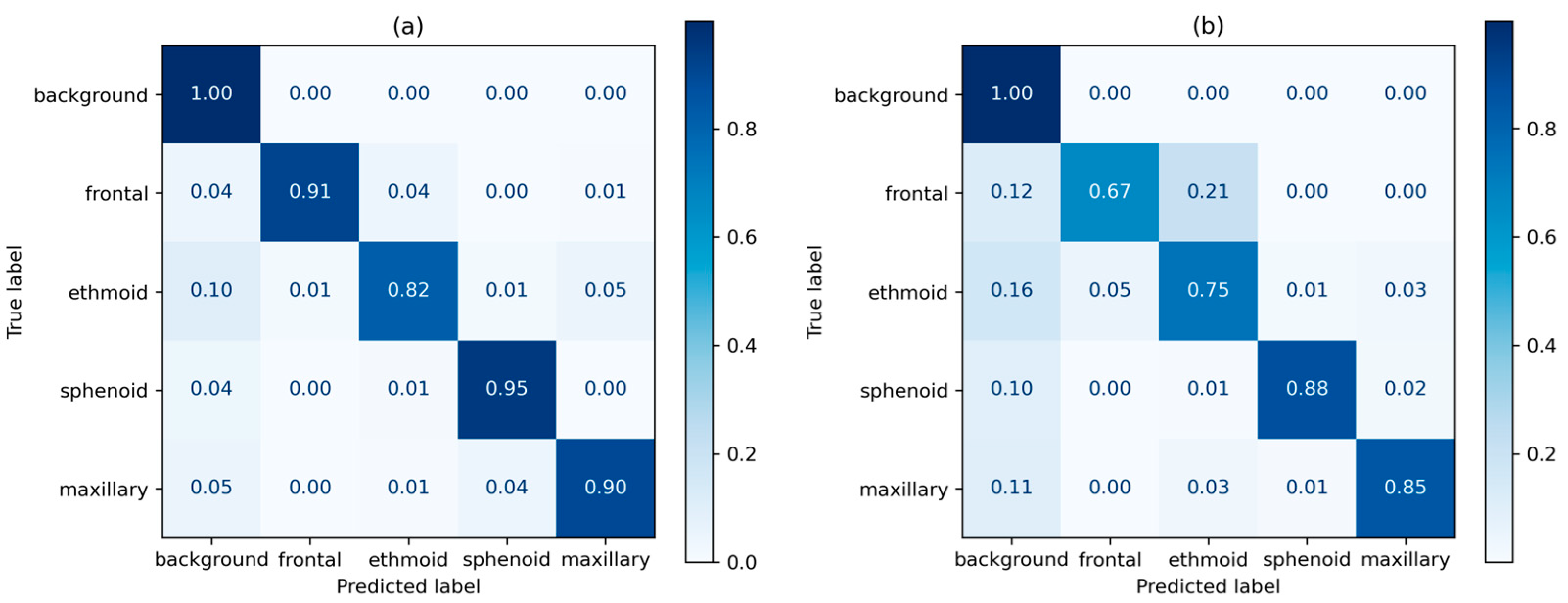 Sensors Free Full Text Deep Learning Based Multi Class Segmentation