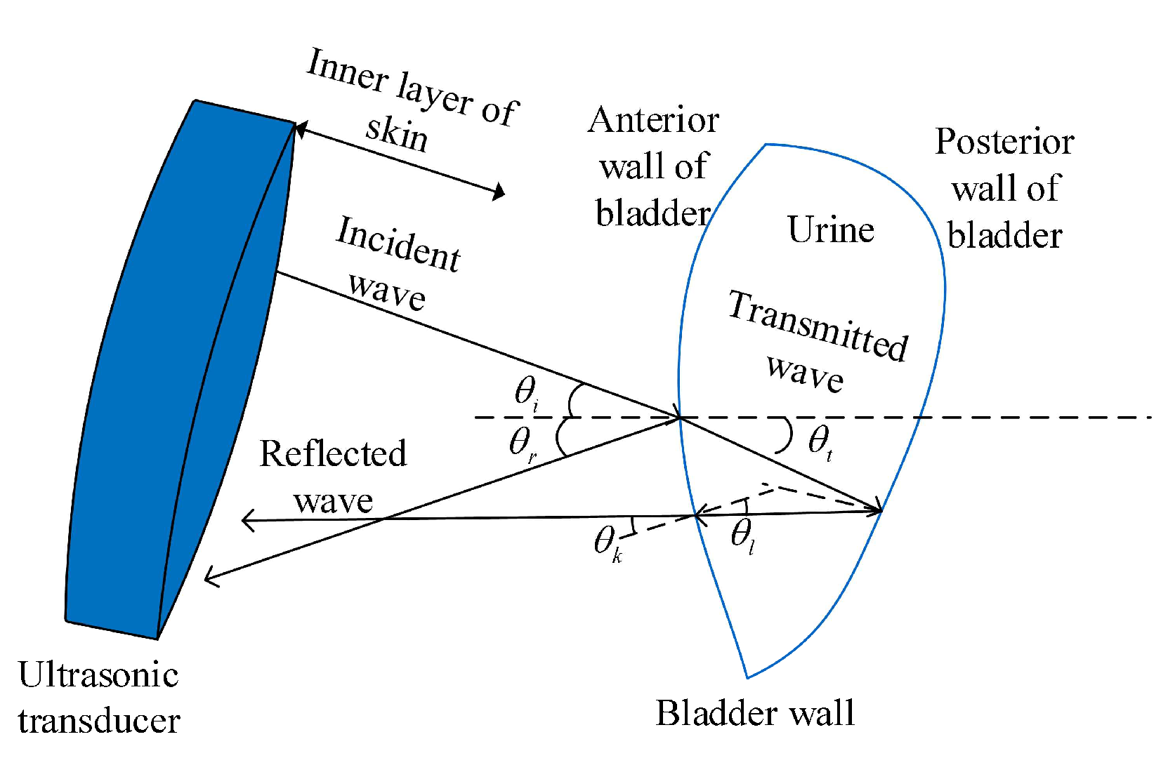 Sensors | Free Full-Text | A-Mode Ultrasound Bladder Volume Estimation Algorithm Based on ...