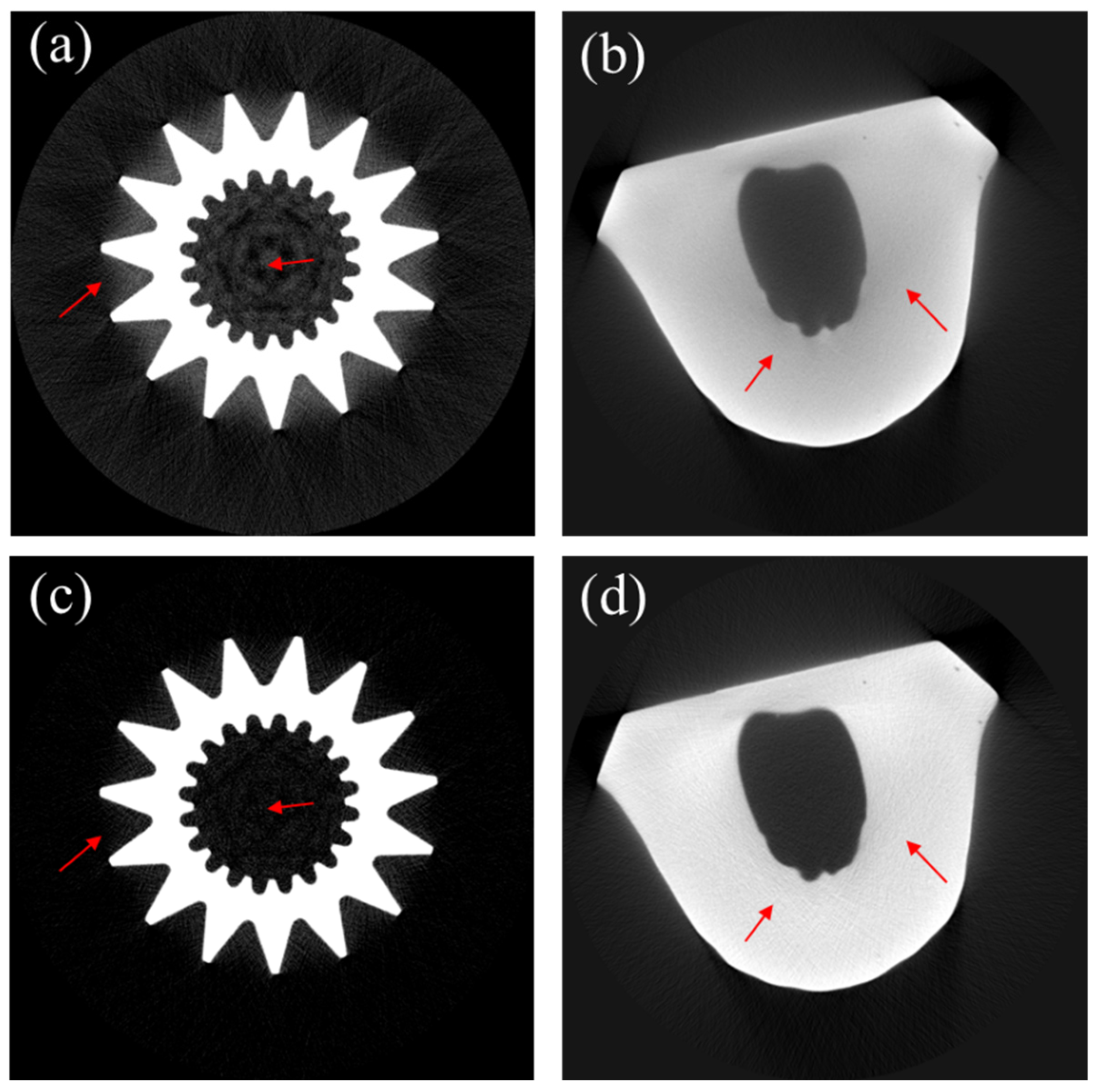 3D Digital Modeling of Dental Casts from Their 3D CT Images with ...