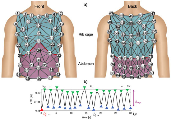 Flexible Textile Sensors-Based Smart T-Shirt for Respiratory Monitoring ...