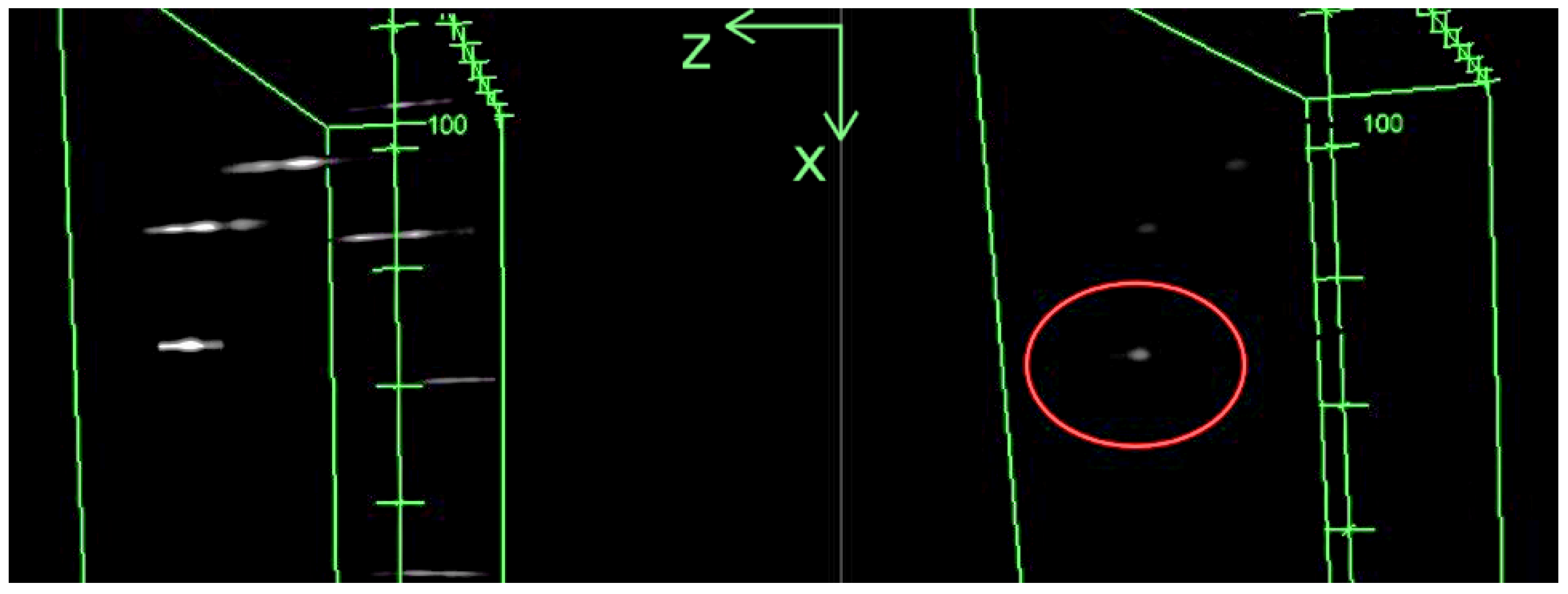Distortion Correction and Denoising of Light Sheet Fluorescence Images