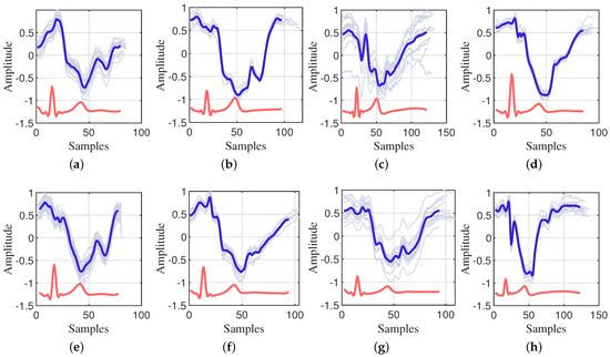 Chest Wall Motion Model of Cardiac Activity for Radar-Based Vital-Sign ...