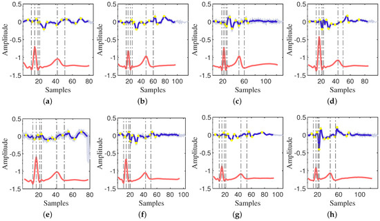 Chest Wall Motion Model of Cardiac Activity for Radar-Based Vital-Sign ...