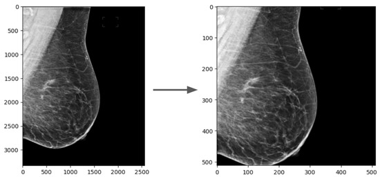 MAM-E: Mammographic Synthetic Image Generation with Diffusion Models