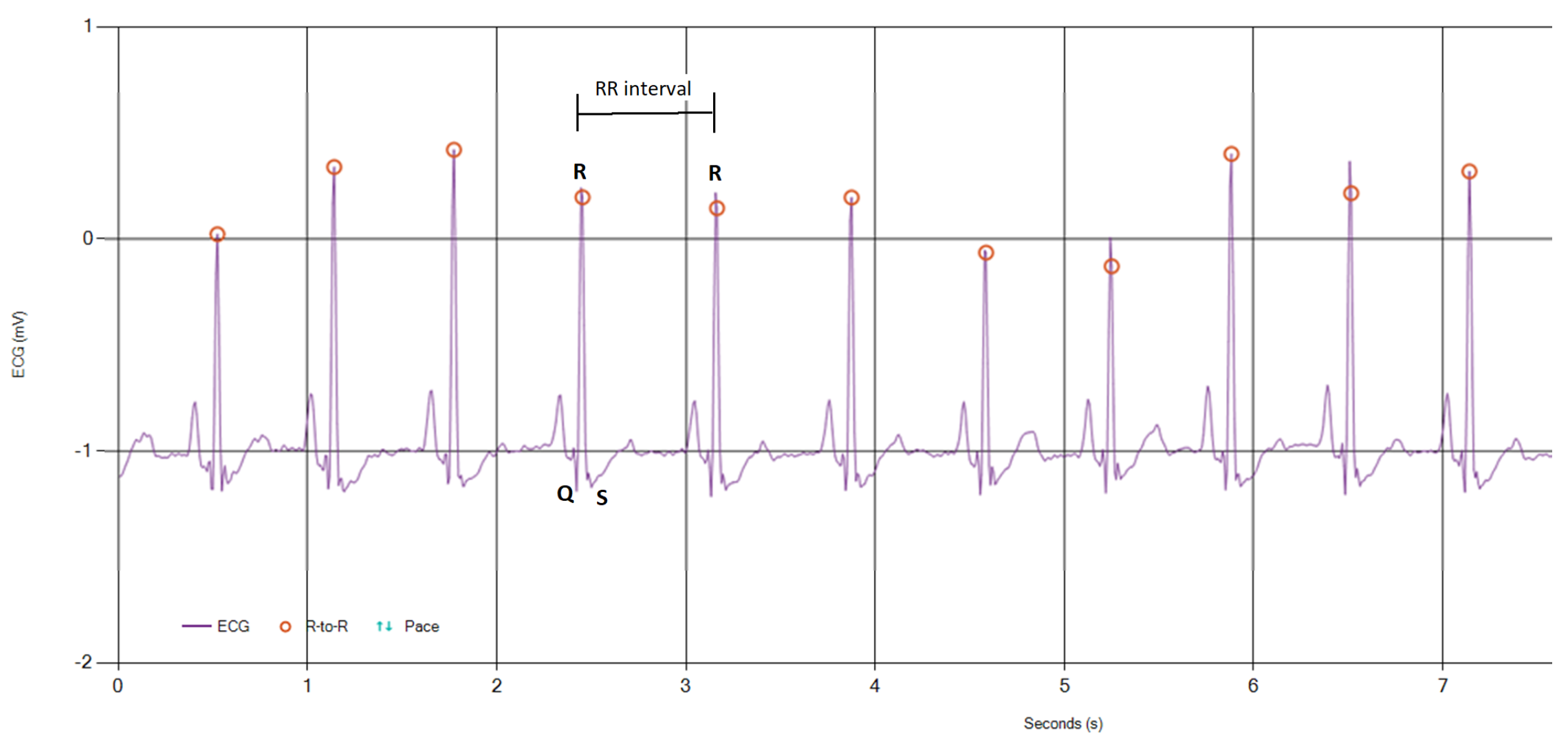 Heart Rate Measurement Using the Built-In Triaxial Accelerometer from a ...