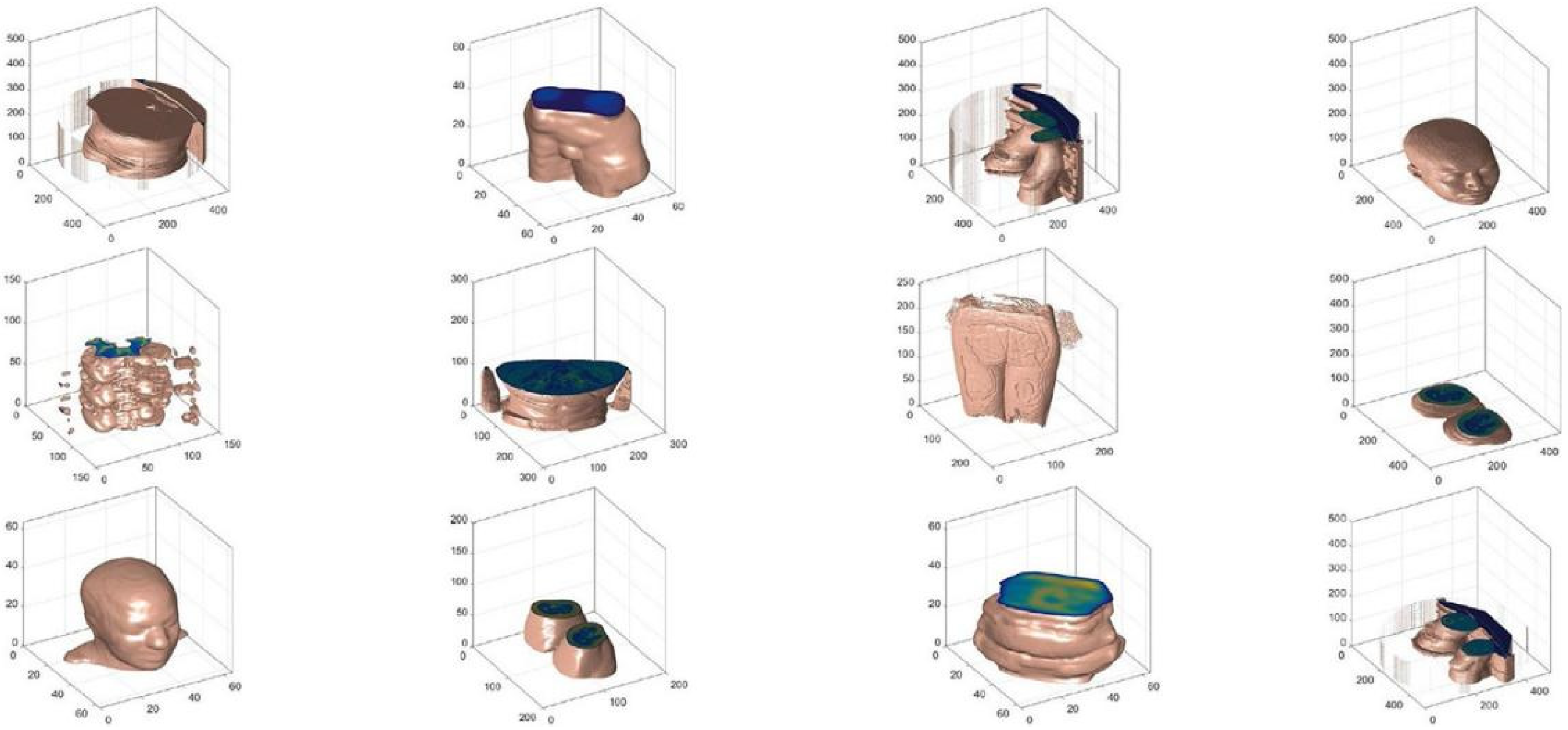 Sensors | Free Full-Text | Recognition of 3D Images by Fusing Fractional-Order Chebyshev Moments ...