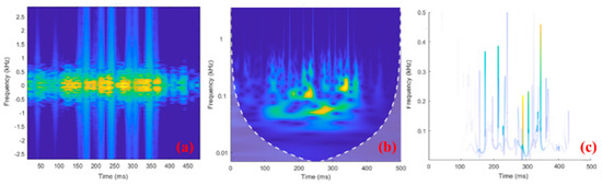 Recognition of Human Lower Limb Motion and Muscle Fatigue Status Using ...