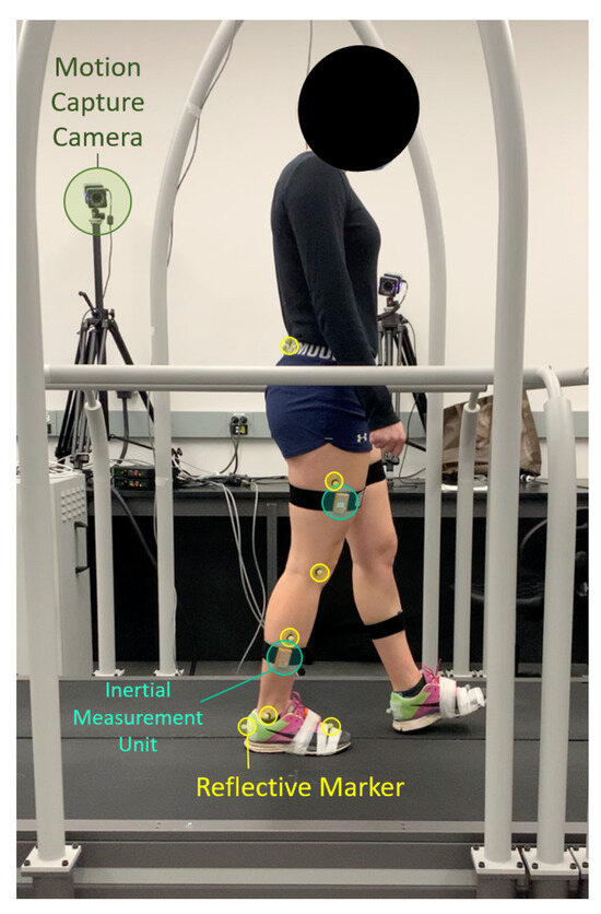 Sensors | Free Full-Text | IMU-Based Real-Time Estimation of Gait Phase Using Multi-Resolution ...