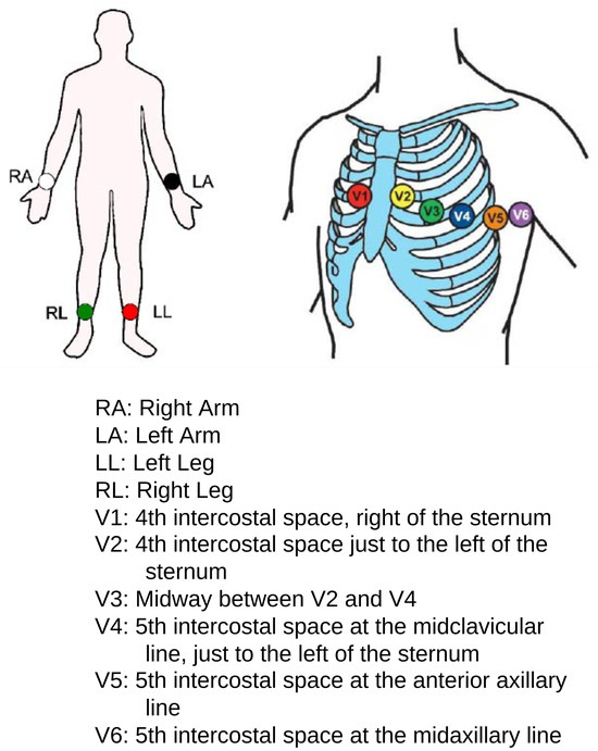 Cardiac Arrhythmia Classification Using Advanced Deep Learning ...