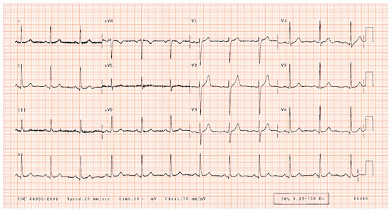 Cardiac Arrhythmia Classification Using Advanced Deep Learning Techniques on Digitized ECG Datasets