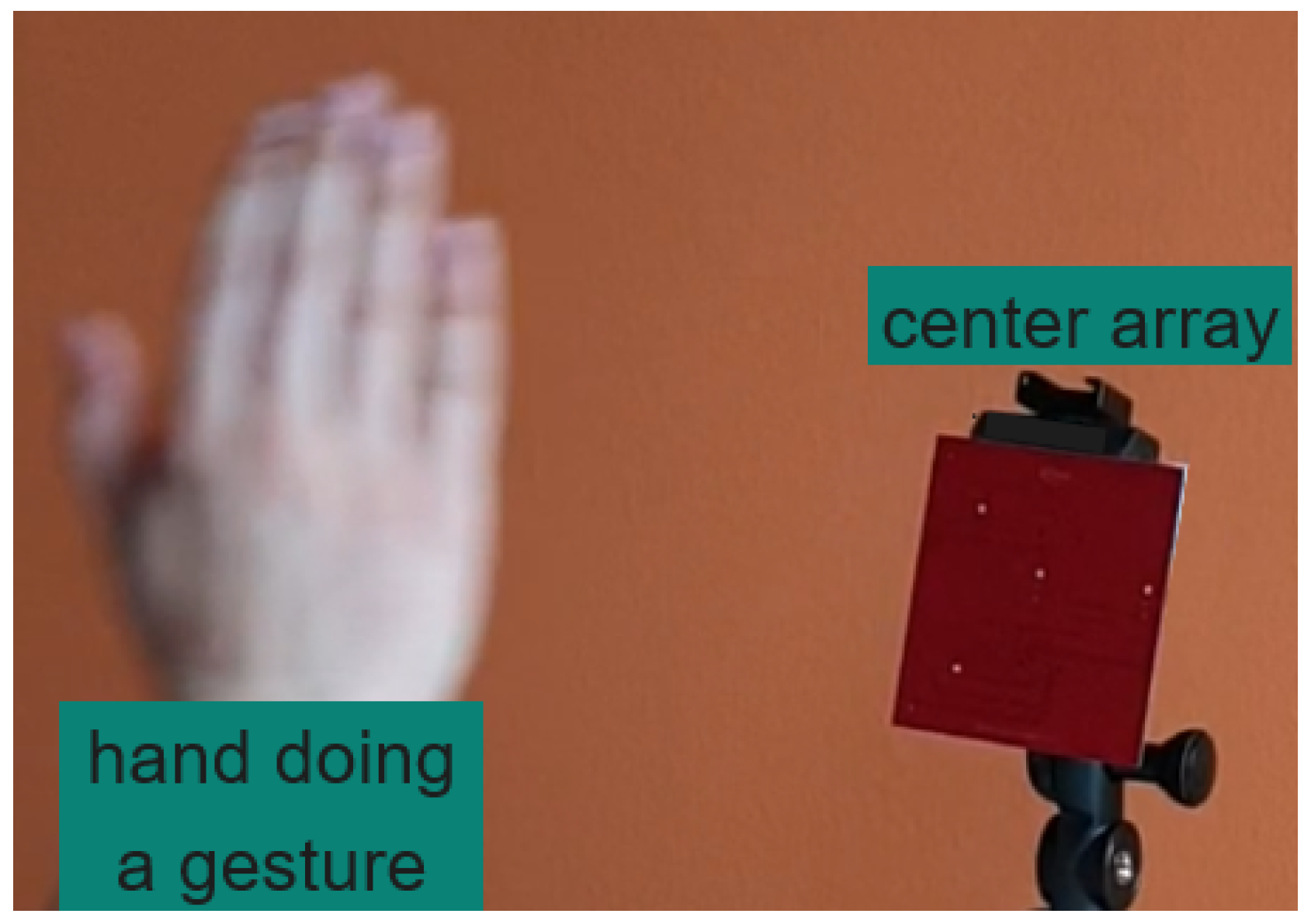 End-to-End Ultrasonic Hand Gesture Recognition