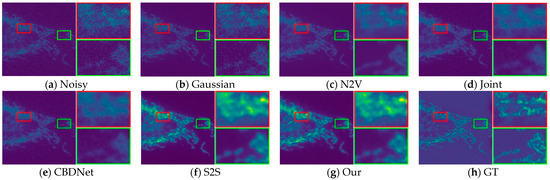 Sensors | Free Full-Text | Self-Supervised Joint Learning for pCLE Image Denoising