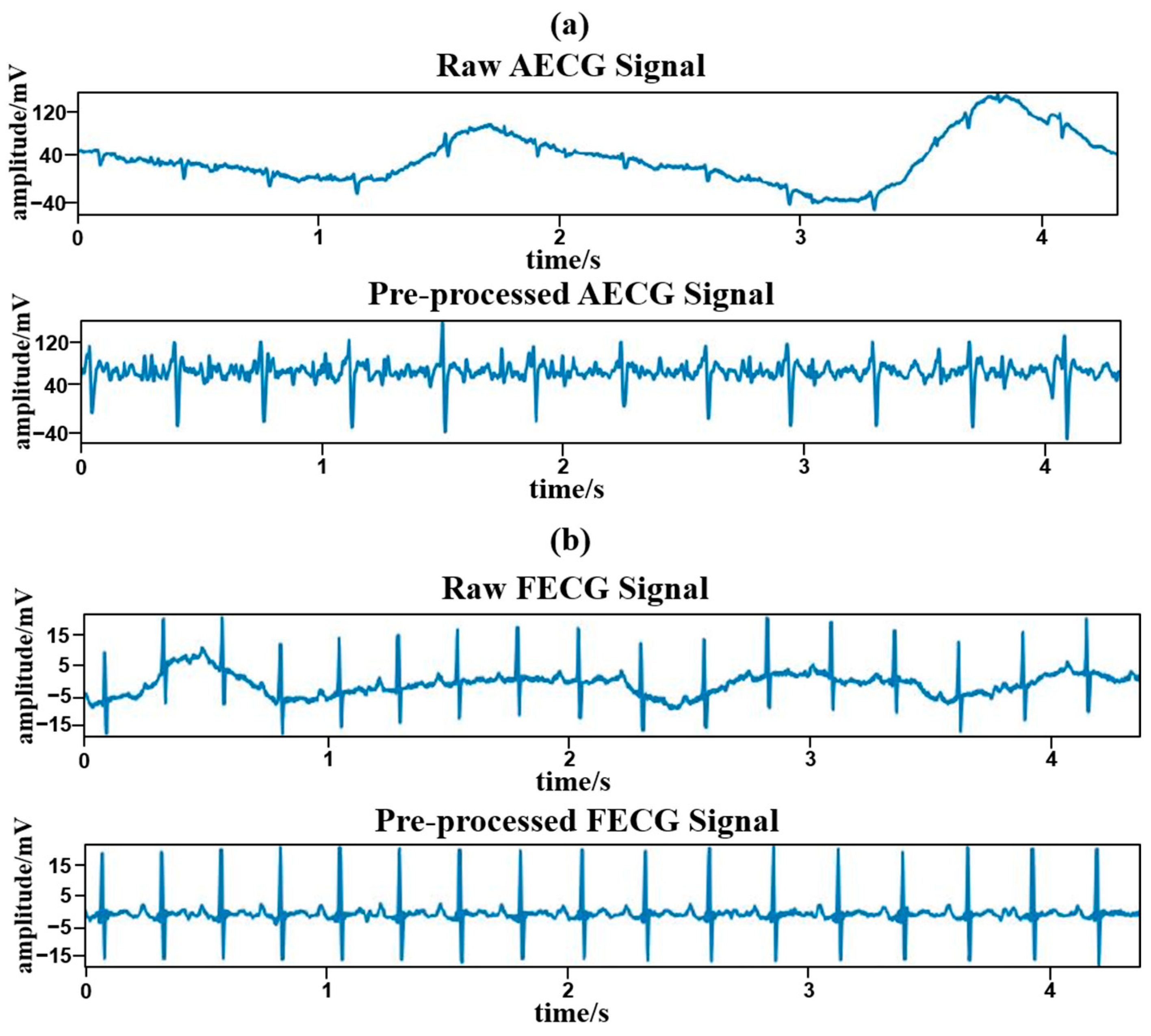 Enhancing Fetal Electrocardiogram Signal Extraction Accuracy through a CycleGAN Utilizing ...