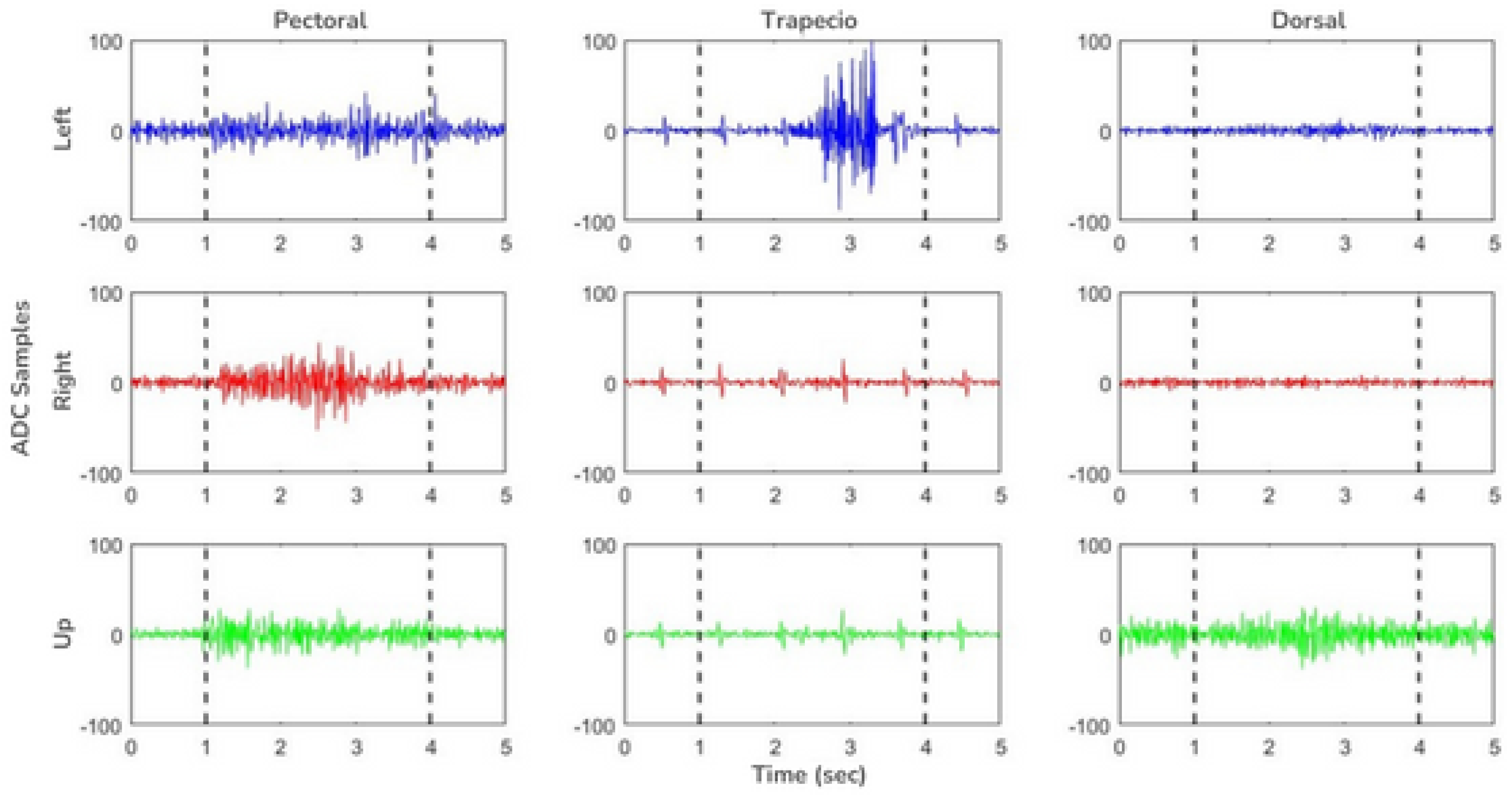Embedded Machine Learning System for Muscle Patterns Detection in a ...