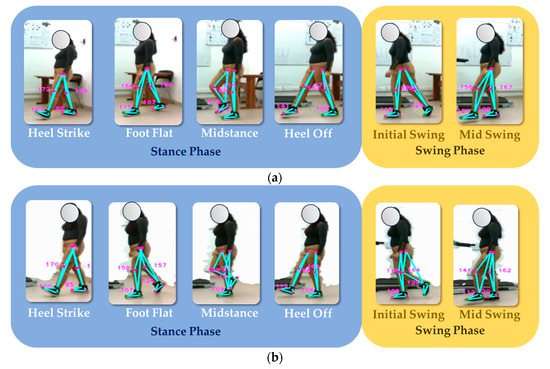 Development of a Low-Cost Markerless Optical Motion Capture System for Gait Analysis and ...