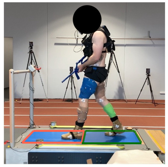 Sensors | Free Full-Text | The Agreement between Wearable Sensors and ...