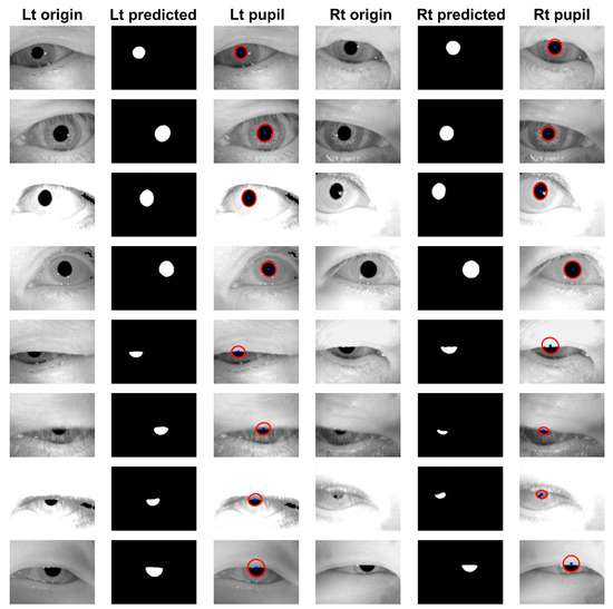 Deep Learning-Based Nystagmus Detection for BPPV Diagnosis