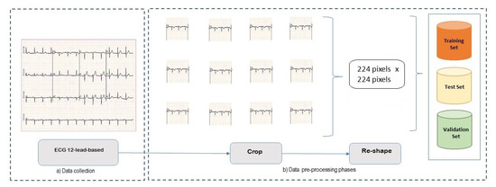 Characterization of Heart Diseases per Single Lead Using ECG Images and CNN-2D