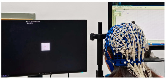 High-Density Electroencephalogram Facilitates the Detection of Small ...