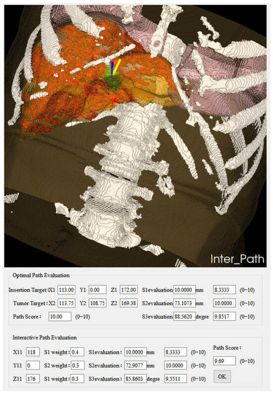 Design of Path-Planning System for Interventional Thermal Ablation of ...