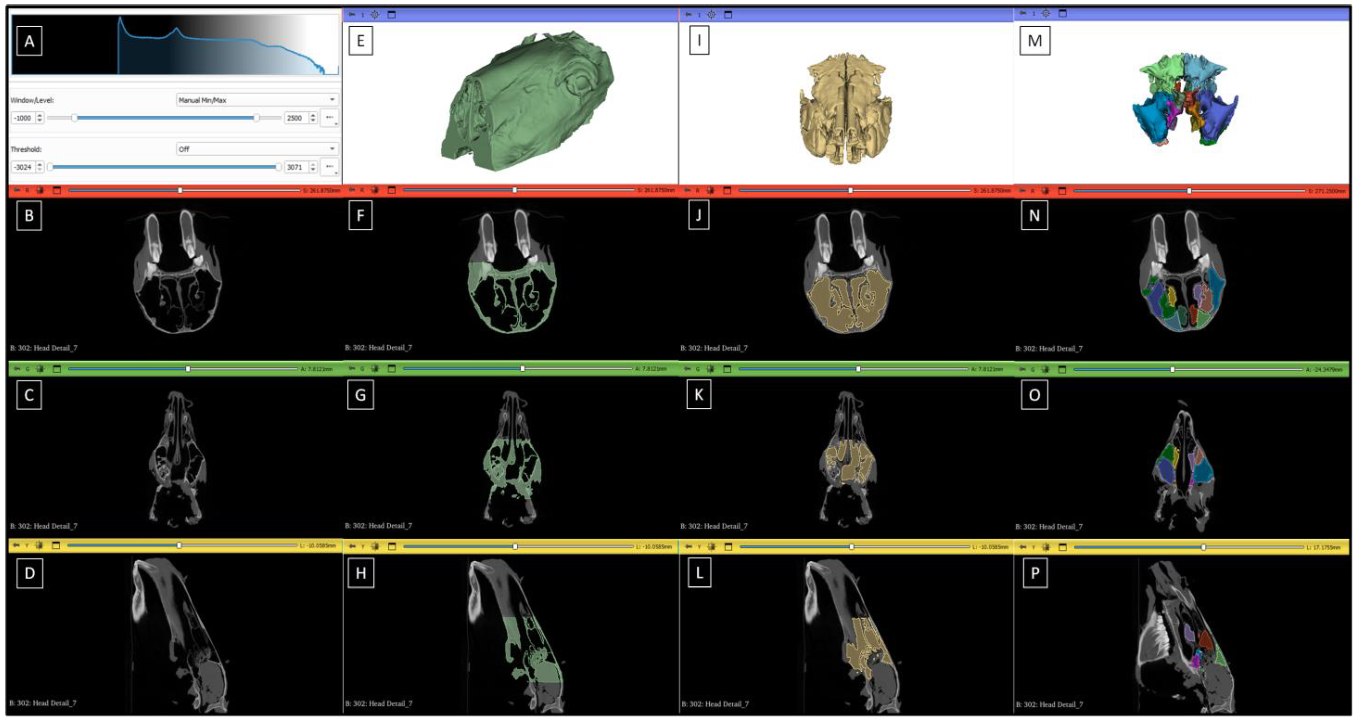 Sensors | Free Full-Text | Three-Dimensional Segmentation of Equine Paranasal Sinuses in ...