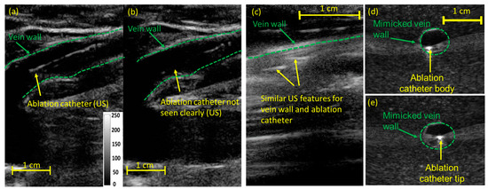 Ultrasound and Photoacoustic Imaging for the Guidance of Laser Ablation ...