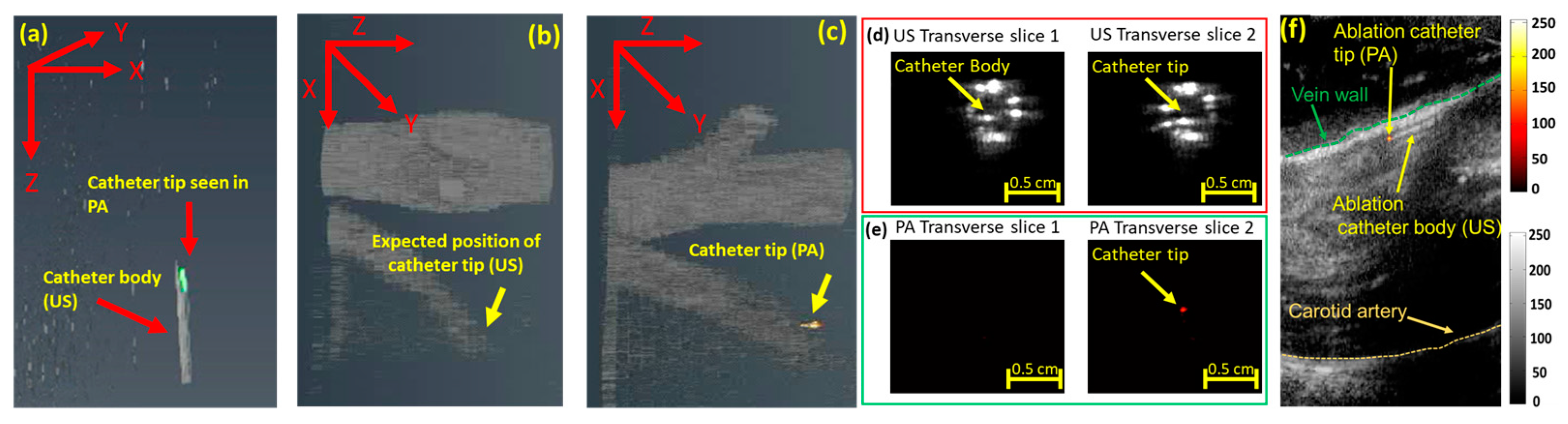 Ultrasound and Photoacoustic Imaging for the Guidance of Laser Ablation ...